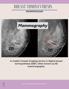 What is a Mammogram? - My Biology Dictionary