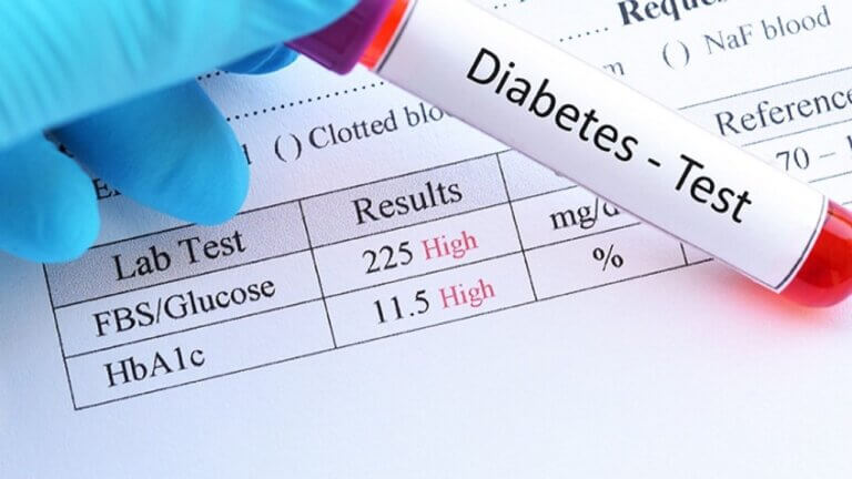 Blood Glucose Test: Preparation, Procedure & Principle