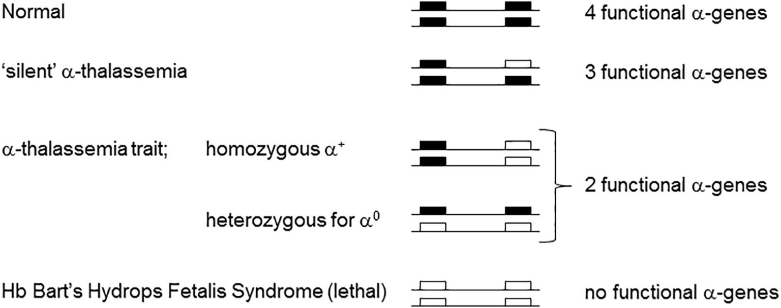 Alpha thalassemia - My Biology Dictionary